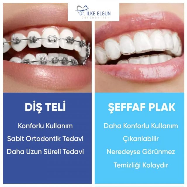 Şeffaf Diş Plak - Invisalign Tedavisi ve Fiyatları 2023